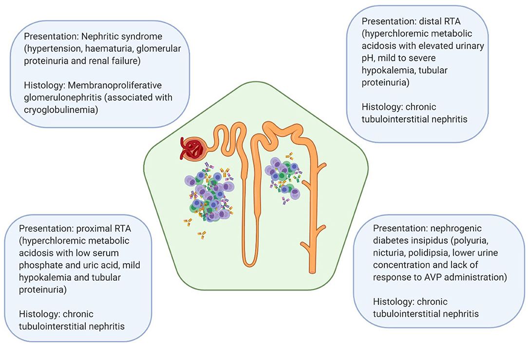 nephrogenic cord nederlands