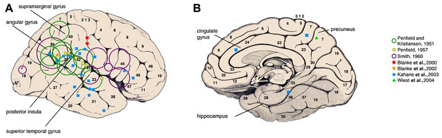 vestibular cortex pattern recognition