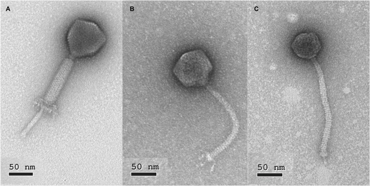 streptococcus faecalis morphology