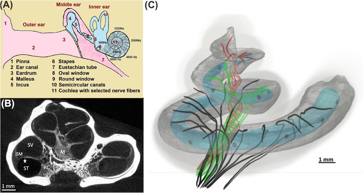 auditory nerve fibers