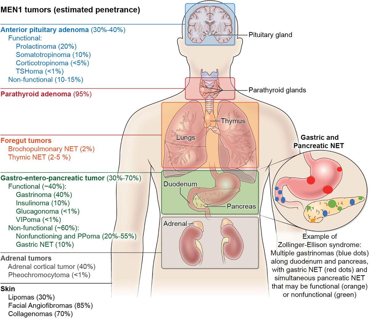 hyperparathyroidism jaw tumor