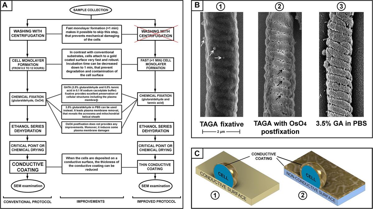 sperm electron microscopy