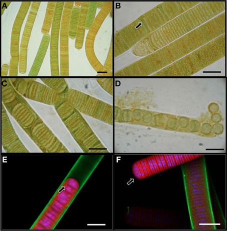 cyanobacteria microscope labeled