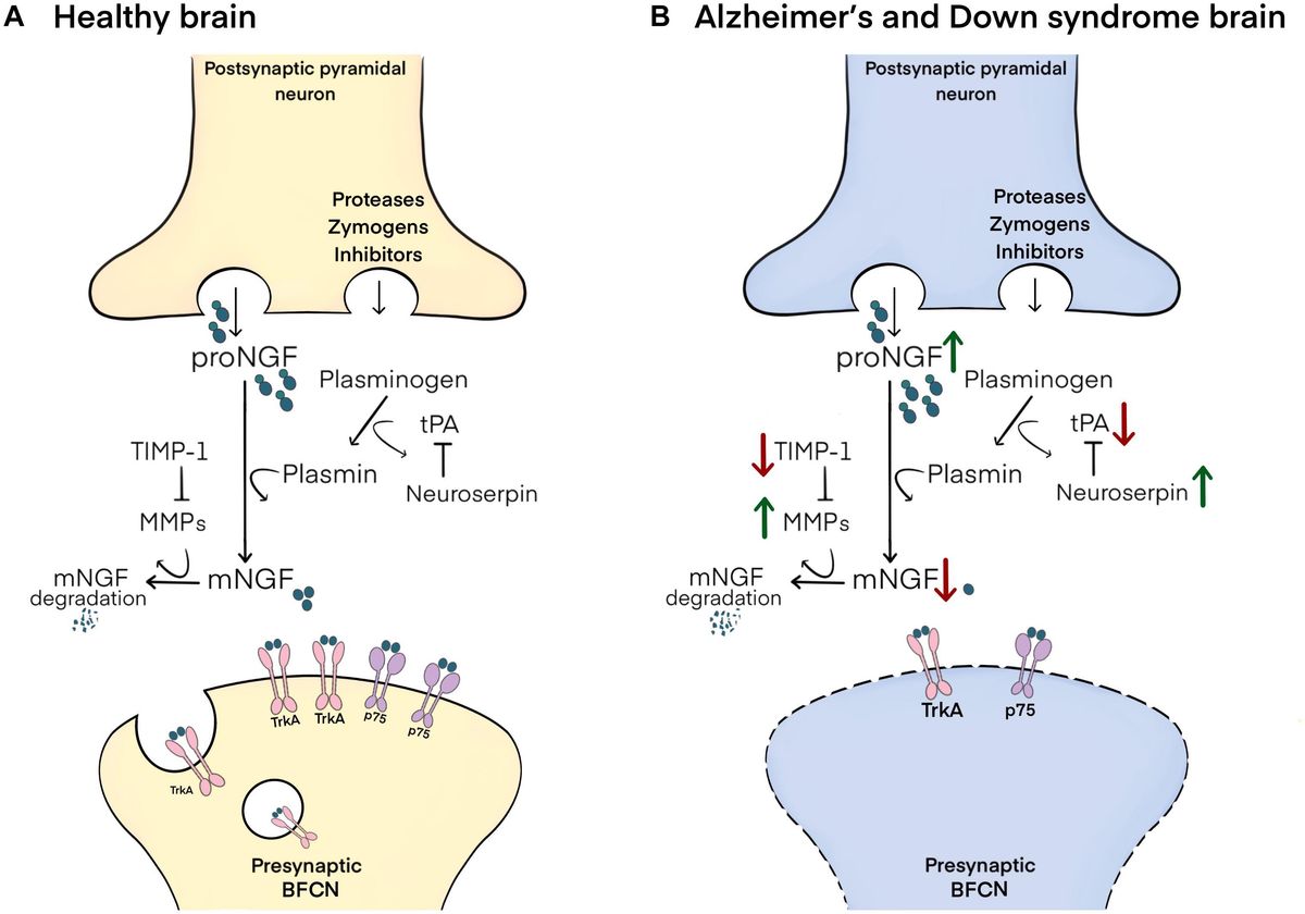 pyramidal syndrome