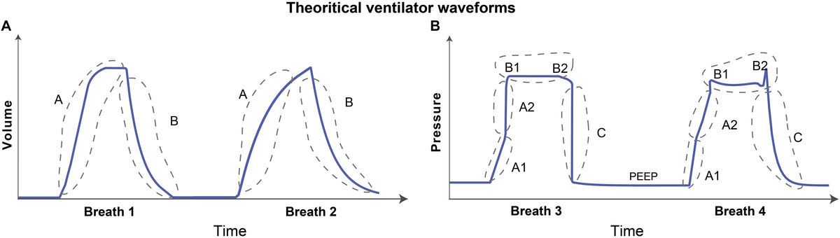 sine waveform ventilator