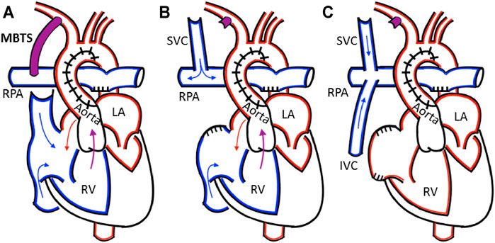cardiac shunt study