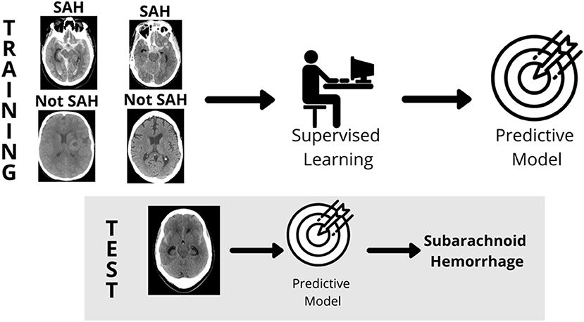 tests for stroke detection