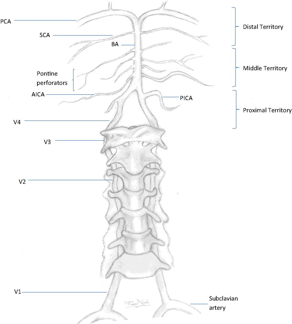 posterior cva