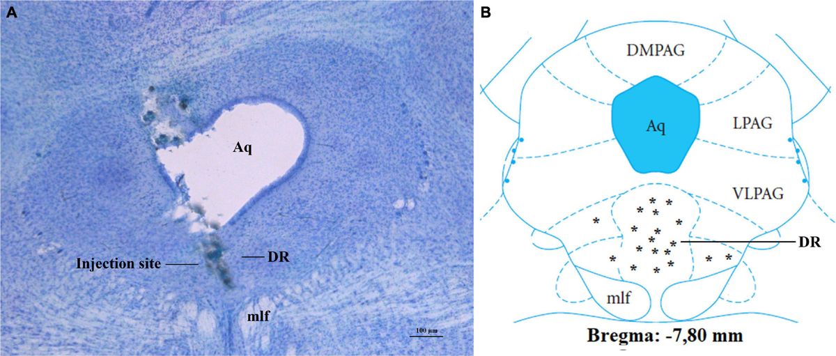 dorsal raphe function