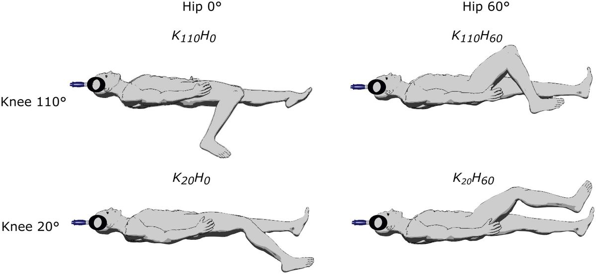 knee extension degrees