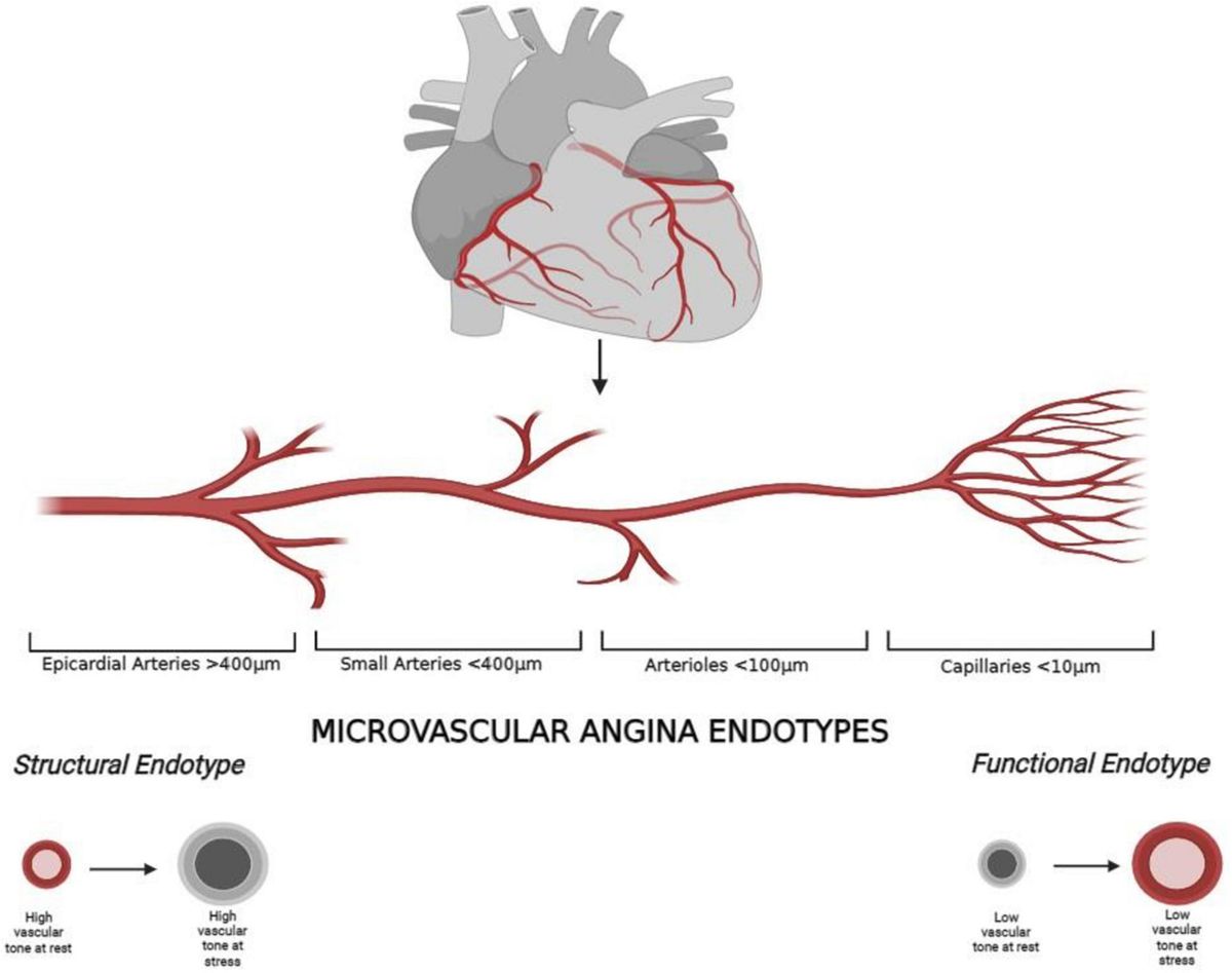 atherosclerosis pathogenesis and microvascular dysfunction