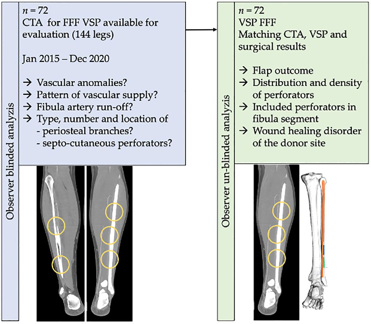fibular pattern