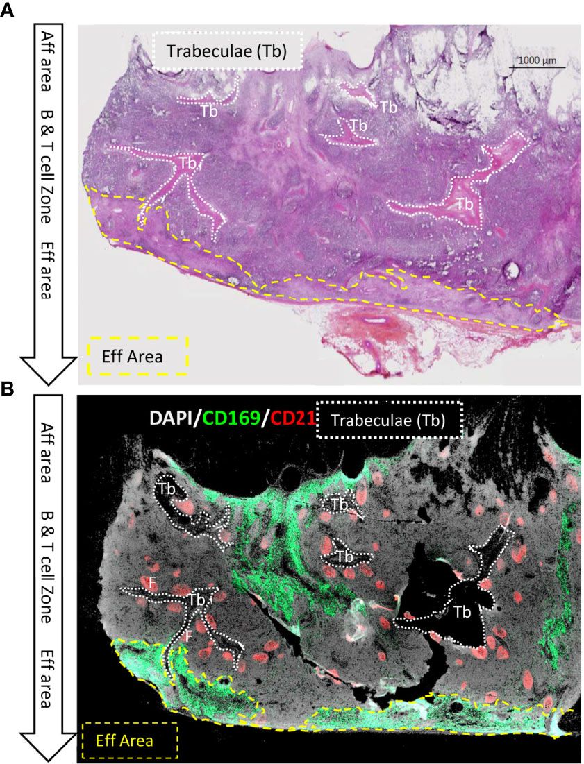 trabeculae lymph node function