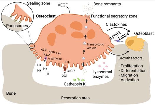 multinucleated giant cells