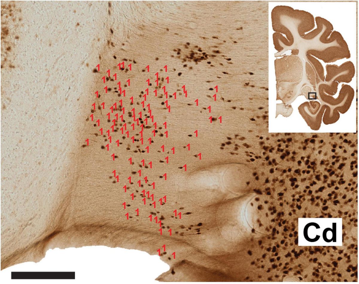 stria terminalis coronal section