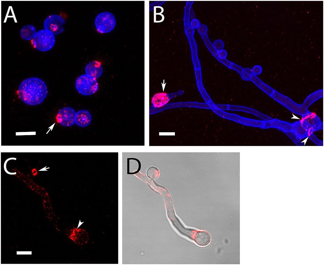 aspergillus terreus complex