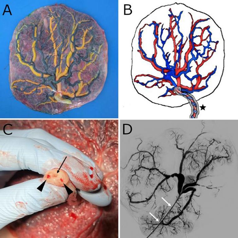 human placenta oldham