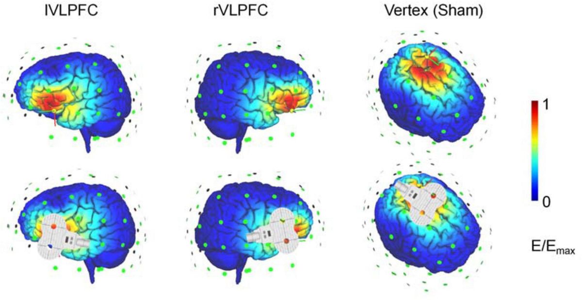 ventrolateral prefrontal cortex中文