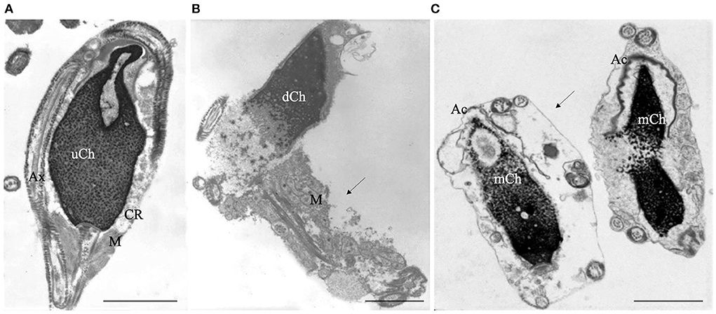 is sperm microscopic