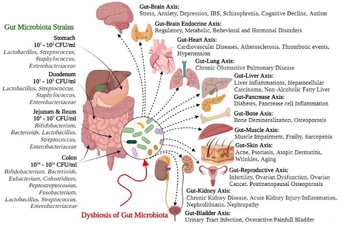 intestinal microbiome disorders