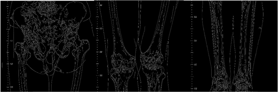 Frontiers | A new automatic stitching method for full-length lower limb ...