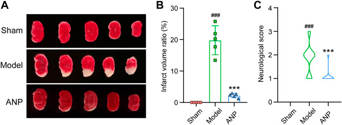 Frontiers | Angong Niuhuang Pill ameliorates cerebral ischemia ...