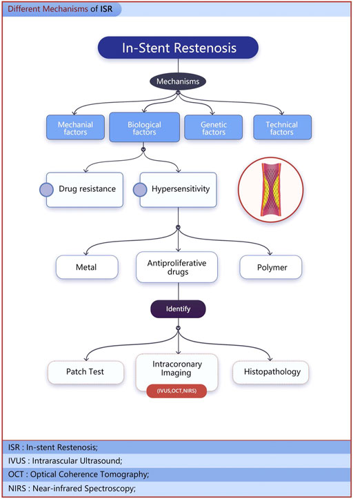 Frontiers | Hypersensitivity and in-stent restenosis in coronary stent ...
