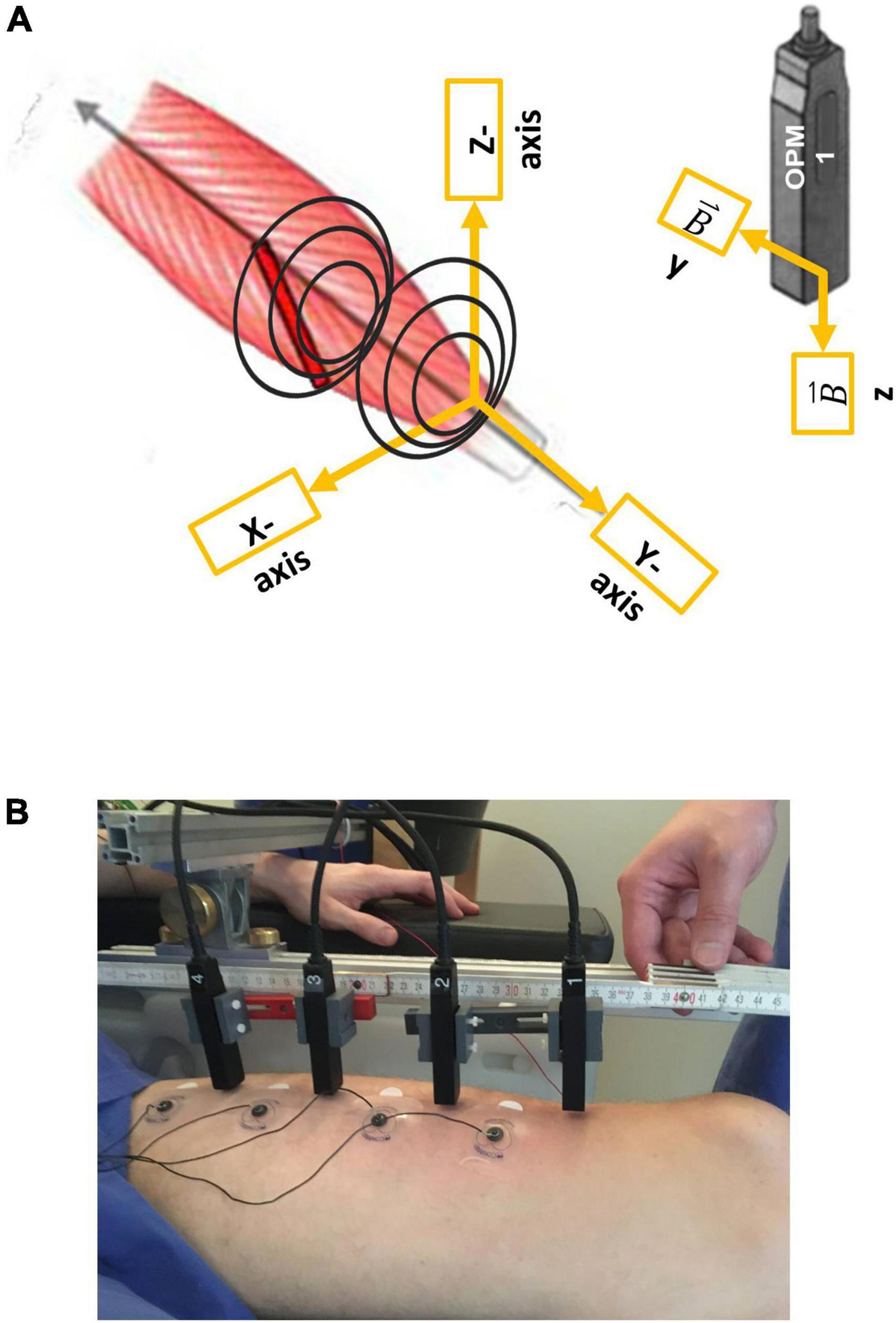 Frontiers | Optically pumped magnetometers detect altered maximal ...