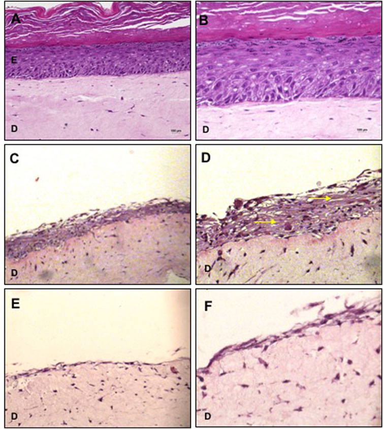 Frontiers | Mesenchymal stem cells express epidermal markers in an in ...