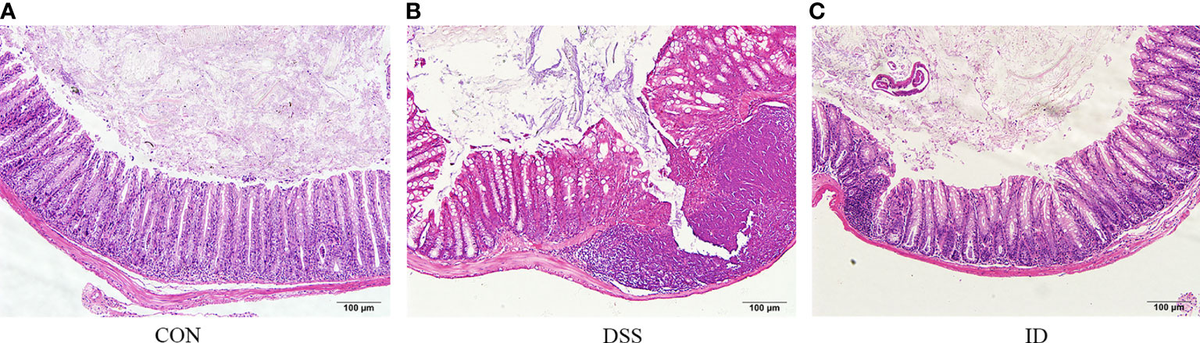 Frontiers | Pretreatment with IPA ameliorates colitis in mice: Colon ...