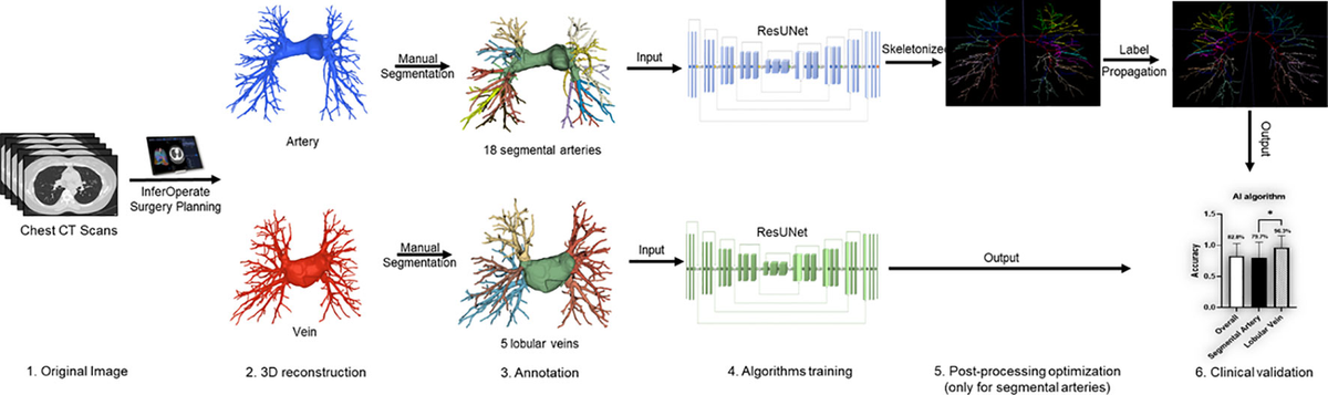 Frontiers | AI-based chest CT semantic segmentation algorithm enables ...