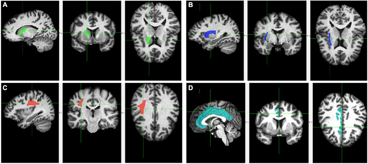 Frontiers | White matter integrity as a mediator between socioeconomic status and executive function