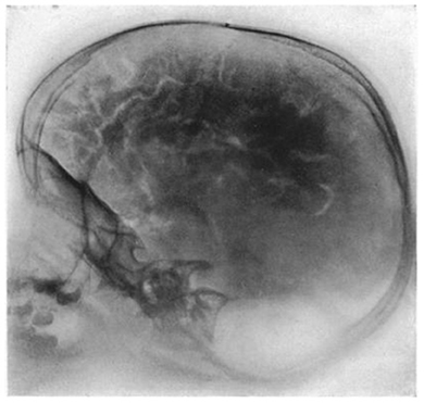 Frontiers | Survey of neuroimaging in neurological surgery, current ...