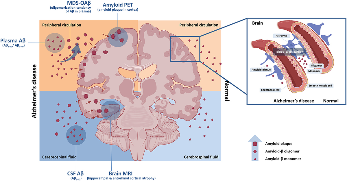 Frontiers | Integration of amyloid-β oligomerization tendency as a ...