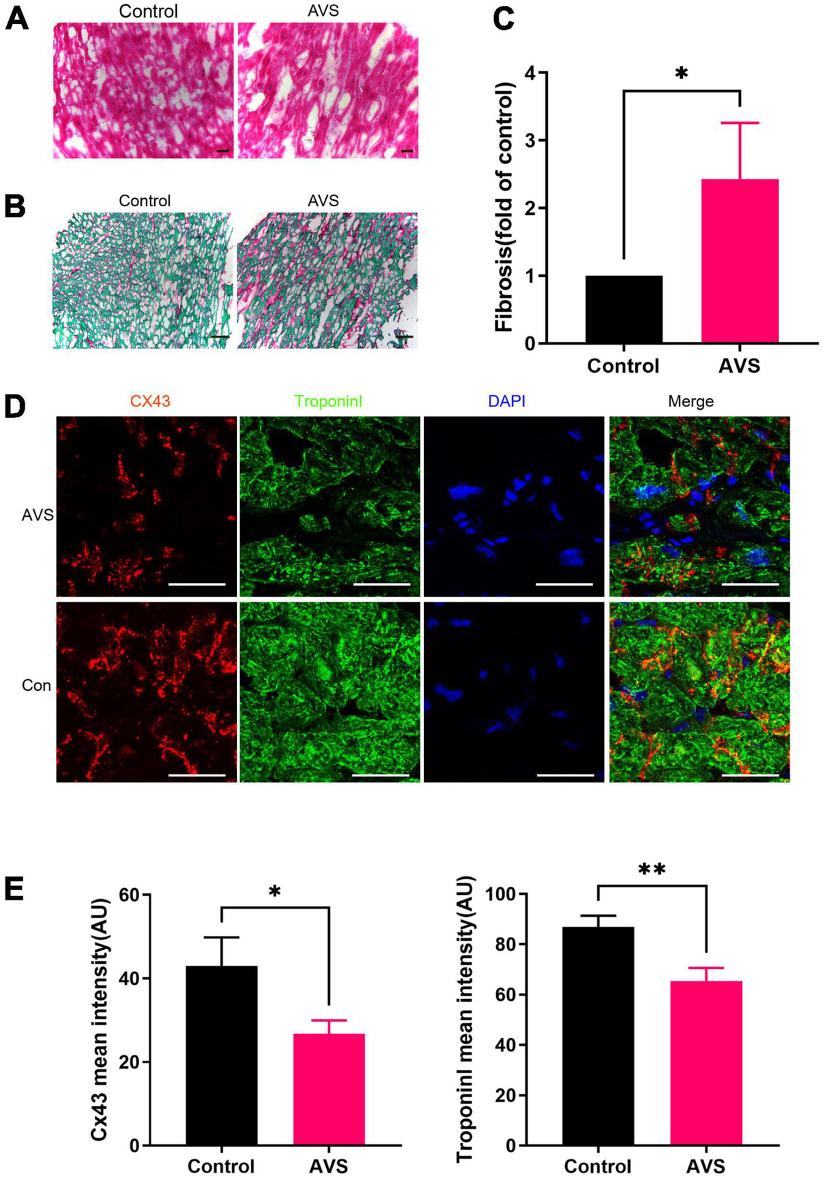 Frontiers | Expression of connexin 43 protein in cardiomyocytes of ...