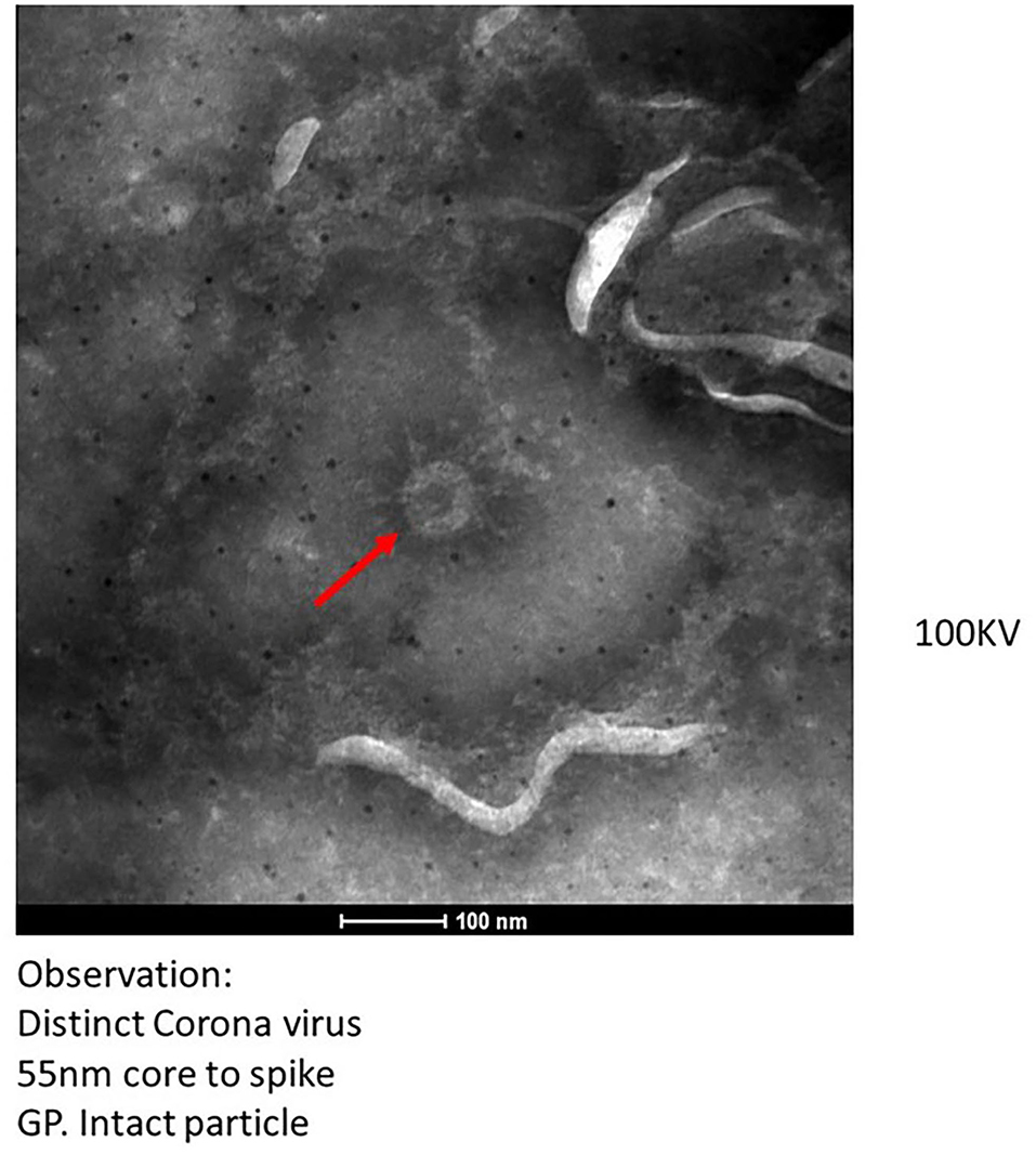 Frontiers | Lack of evidence of viability and infectivity of SARS-CoV-2 ...