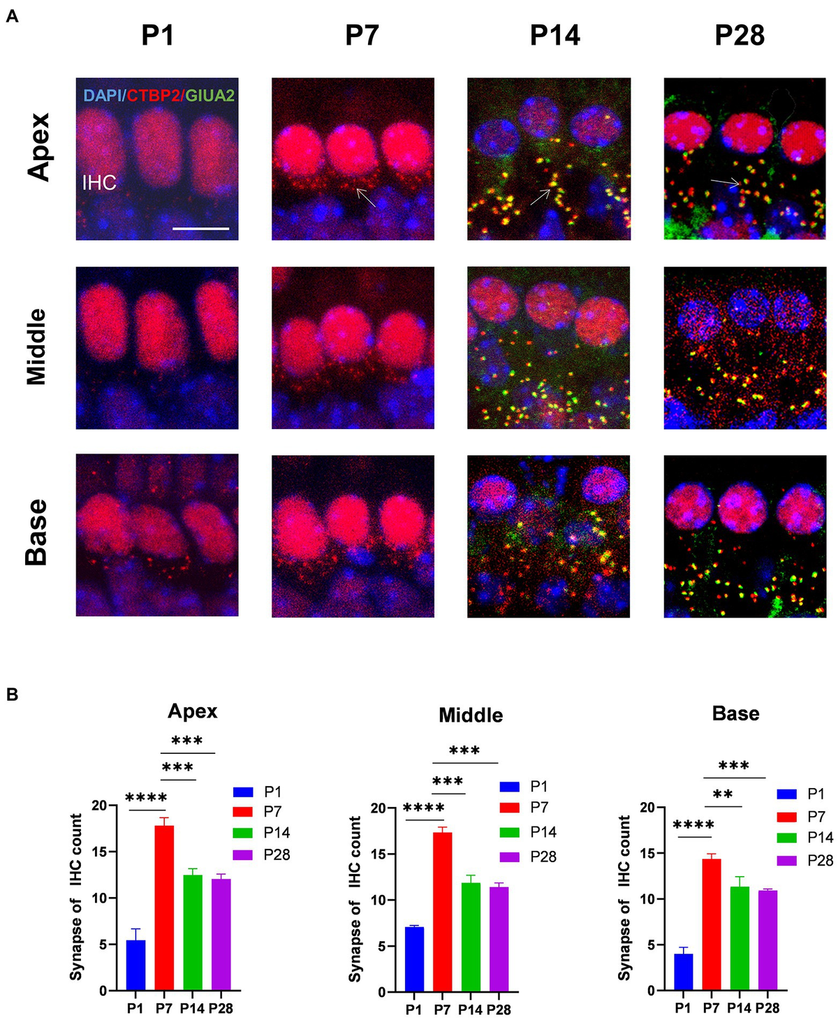 Frontiers | Cochlear resident macrophage mediates development of ribbon ...
