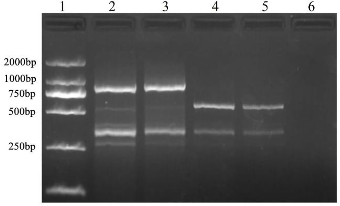 Frontiers | Development of real-time PCR and droplet digital PCR based marker for the detection ...