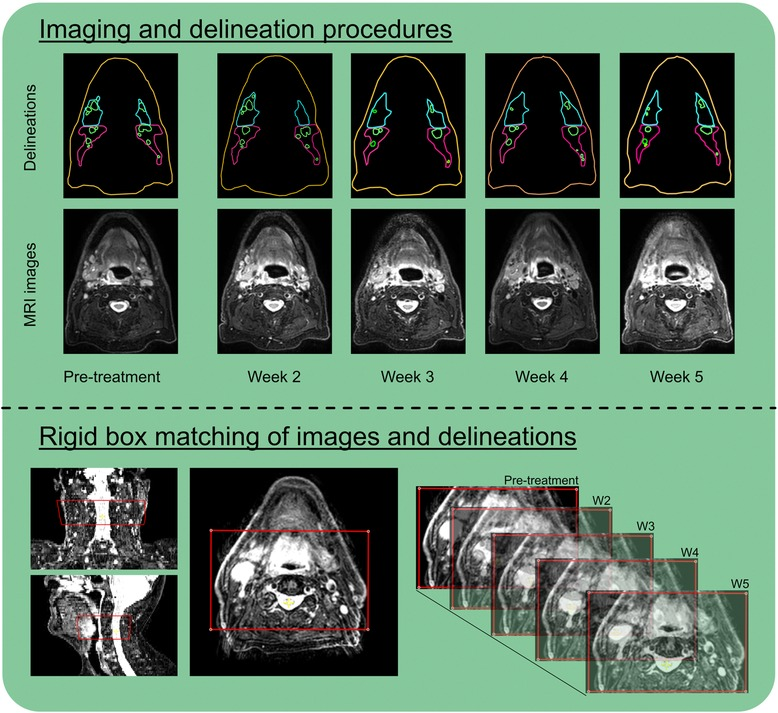 Frontiers | MRI visibility and displacement of elective lymph nodes ...