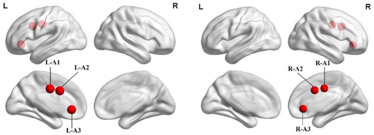 Frontiers | Altered anterior cingulate cortex subregional connectivity associated with ...