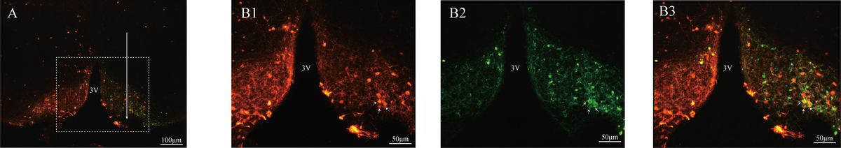 Frontiers | Optogenetic stimulation of Kiss1ARC terminals in the AVPV ...