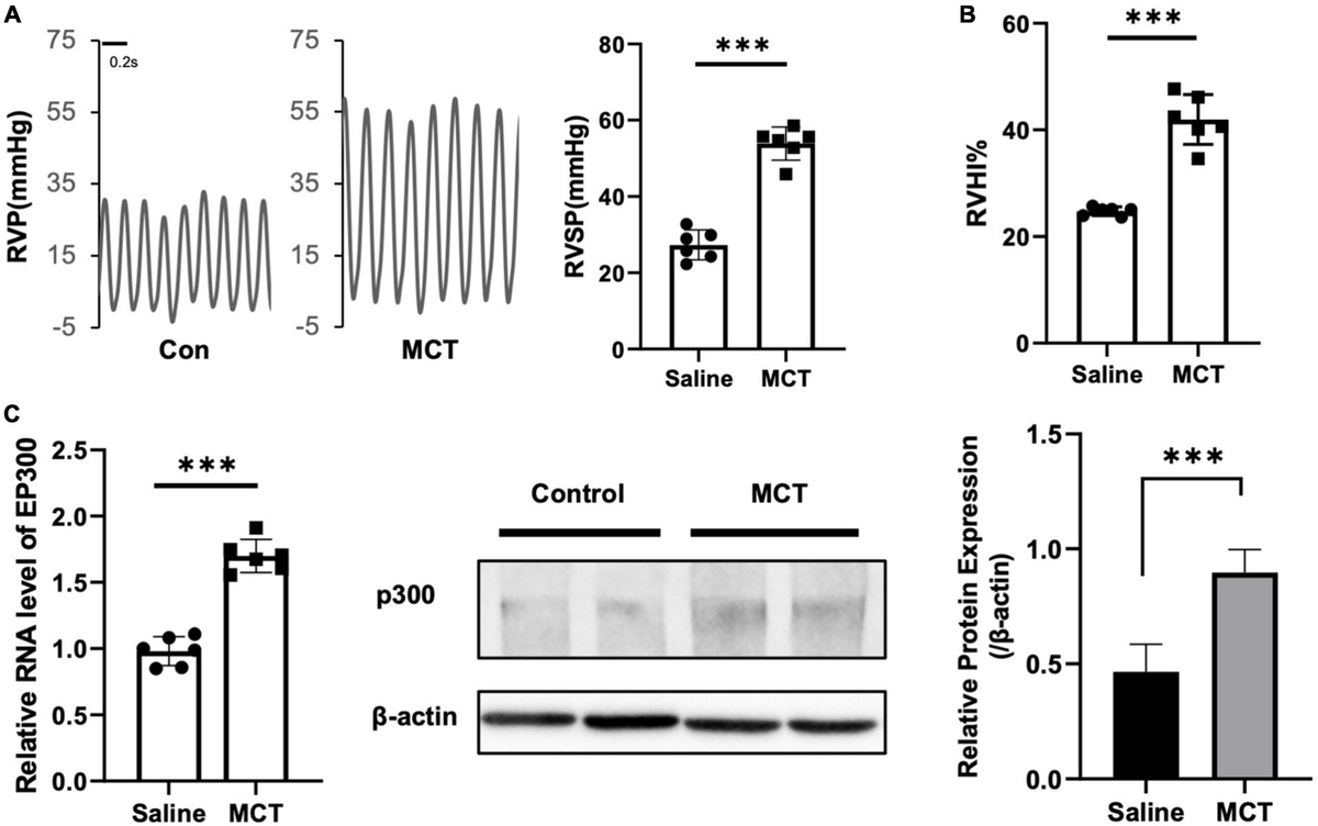 Frontiers | The protective role of EP300 in monocrotaline-induced ...