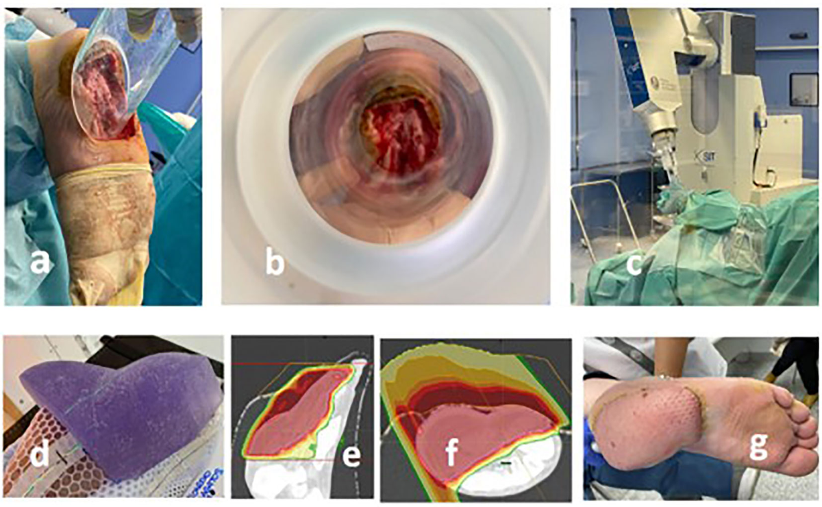 Frontiers | Practice-oriented solutions integrating intraoperative ...