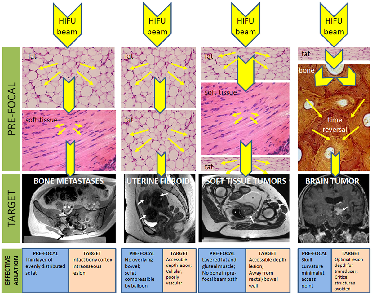 Frontiers | Tissue specific considerations in implementing high ...