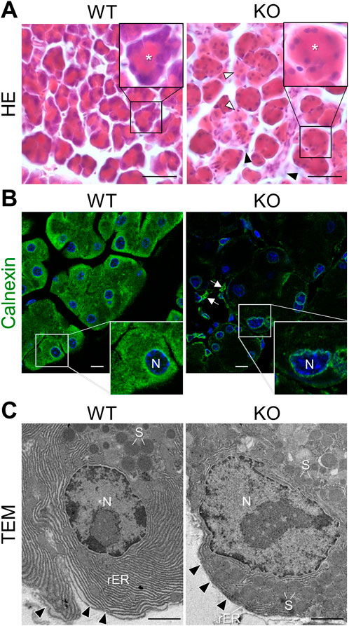 Frontiers | Loss of CAPS2/Cadps2 leads to exocrine pancreatic cell ...