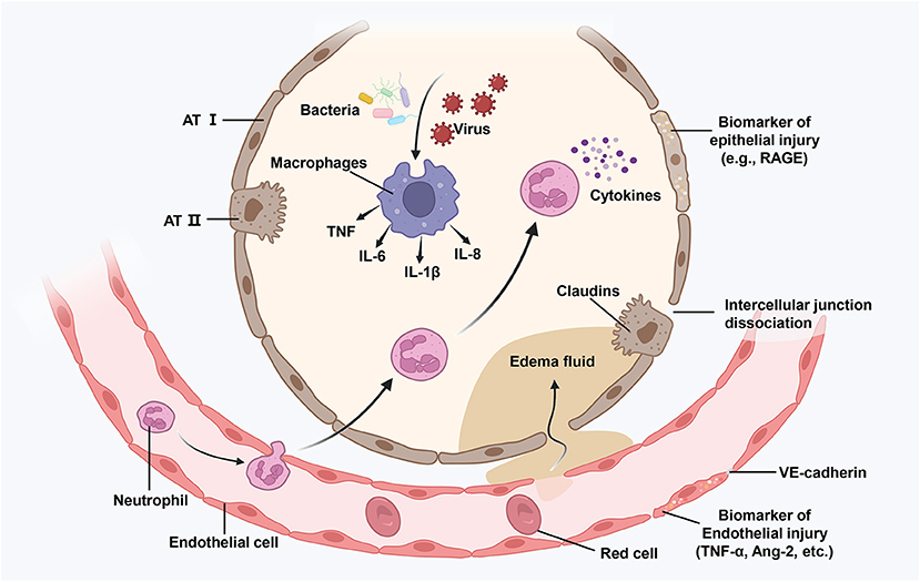 Frontiers | Advanced development and mechanism of sepsis-related acute ...