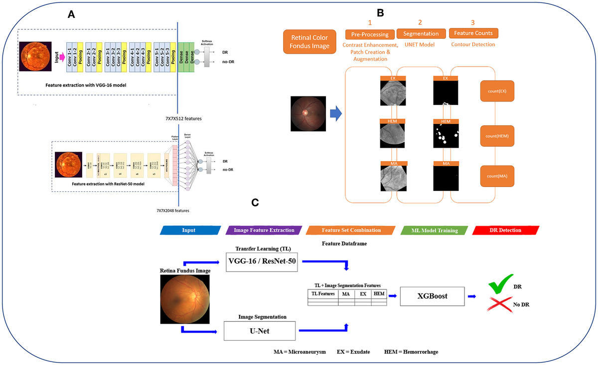 Frontiers | Combining transfer learning with retinal lesion features for accurate detection of ...