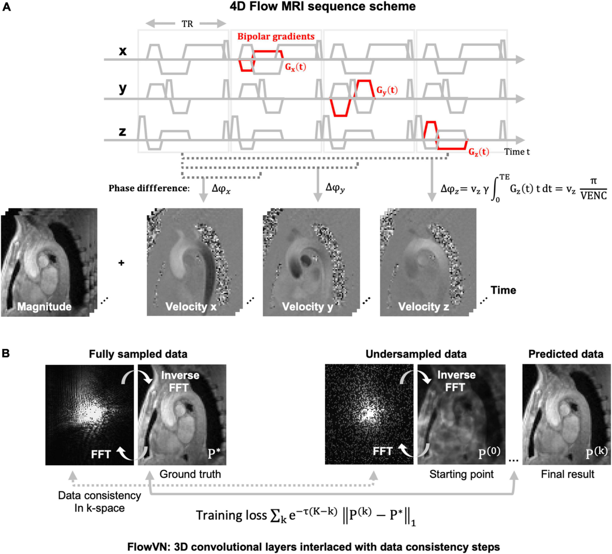 Frontiers | Advances in machine learning applications for cardiovascular 4D flow MRI