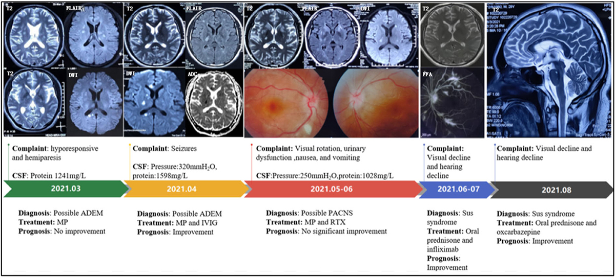 Frontiers | Misdiagnosis of Susac syndrome as demyelinating disease and primary angiitis of the ...
