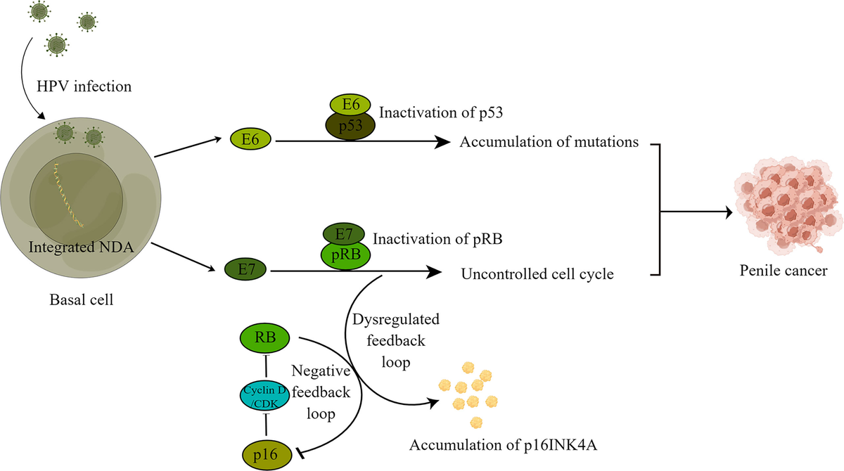 Frontiers | Immune landscape and immunotherapy for penile cancer
